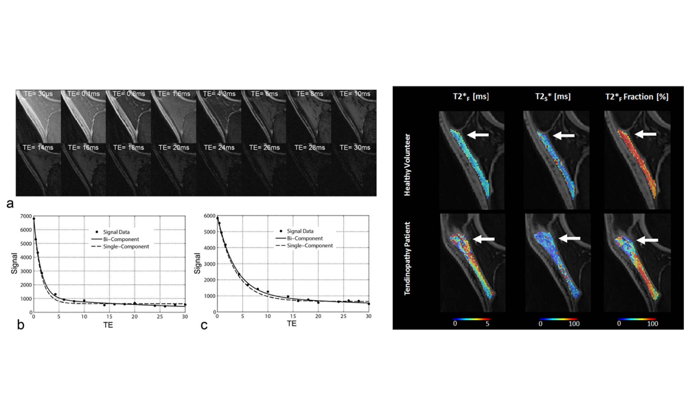 Intelligent Imaging Innovation and Translation Lab – Laboratory of Fang ...