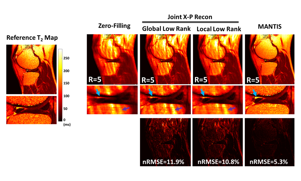 Intelligent Imaging Innovation and Translation Lab – Laboratory of Fang ...